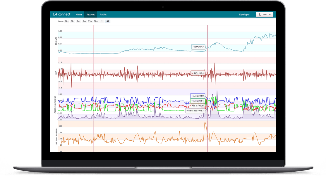 E4 wristband | Real-time physiological signals | Wearable PPG, EDA ...
