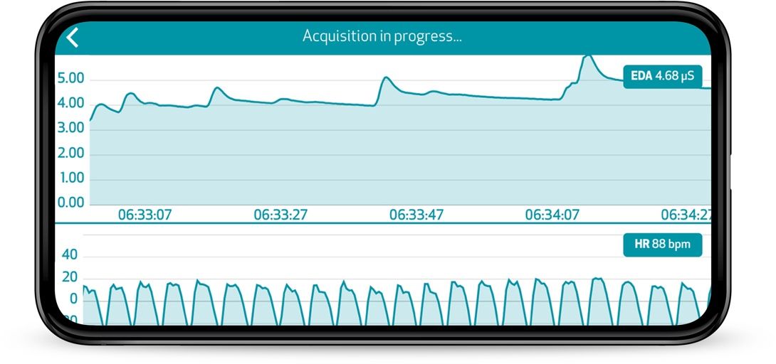 E4 wristband | Real-time physiological signals | Wearable PPG, EDA ...