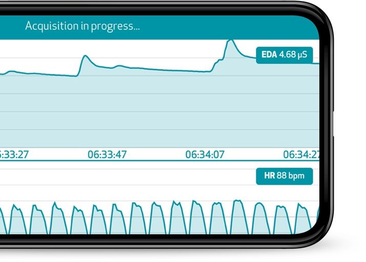 E4 wristband | Real-time physiological signals | Wearable PPG, EDA, Temperature, Motion sensors